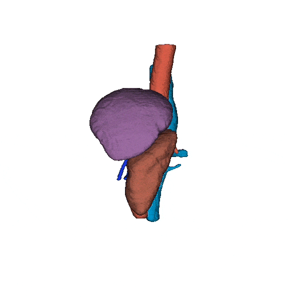 SurgicalVision 3D