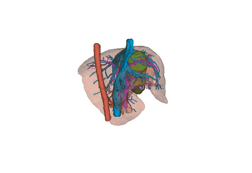 Surgery - Colorectal – SurgicalVision 3D